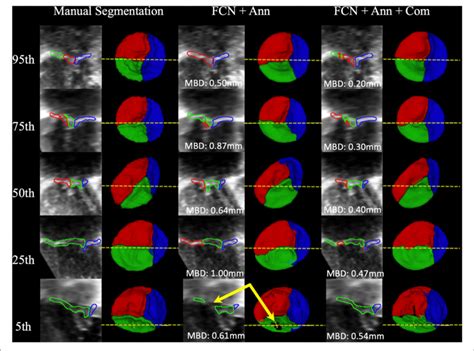 Examples Of Segmentations Predicted By The FCN From Left To Right Download Scientific