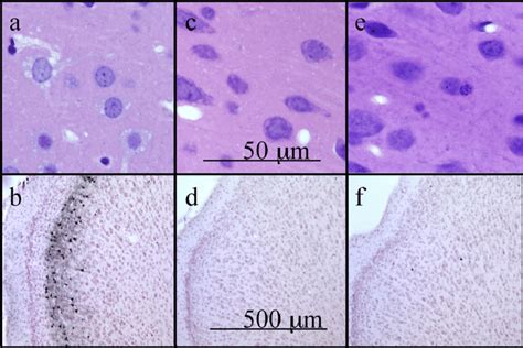 Representative Histological Sections Of The Retrosplenial Cortex From