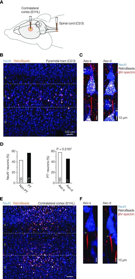 Covariation Of Axon Initial Segment Location And Dendritic Tree Normalizes The Somatic Action