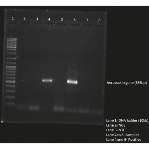 Gel Image Of Detection And Amplification By Polymerase Chain Reaction