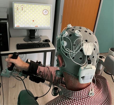 Anodal Hd Tdcs Applied To The Ipsilesional Primary Motor Cortex During Download Scientific