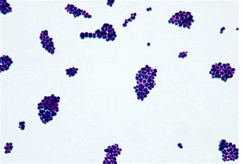 Peptostreptococcus Gram Stain
