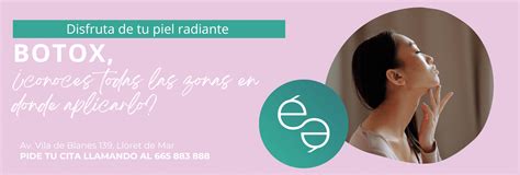 ¿conoces Todas Las Zonas En Donde Se Puede Aplicar Botox Clinica Esmedic