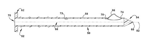Method And Apparatus For Tissue Sampling Eureka Patsnap