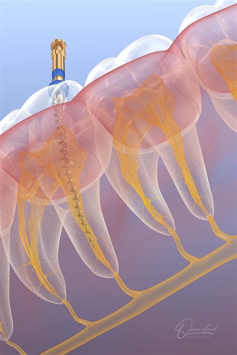 About — Queensland Endodontics