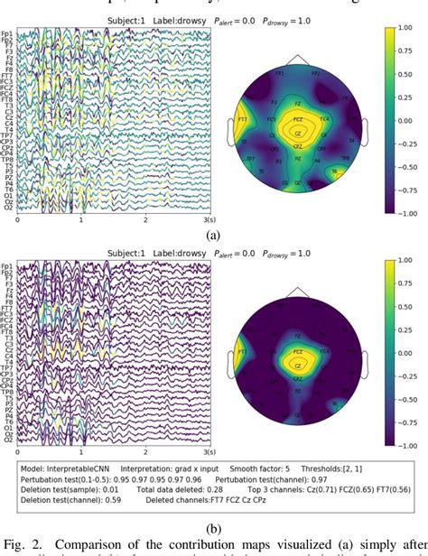Figure 2 From Towards Best Practice Of Interpreting Deep Learning Models For Eeg Based Brain