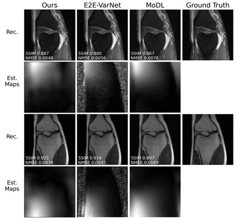 Deep J Sense Accelerated Mri Reconstruction Via Unrolled Alternating