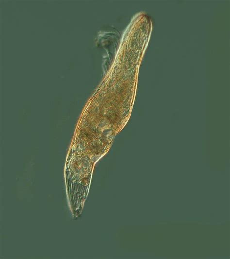 Blepharisma Under Microscope