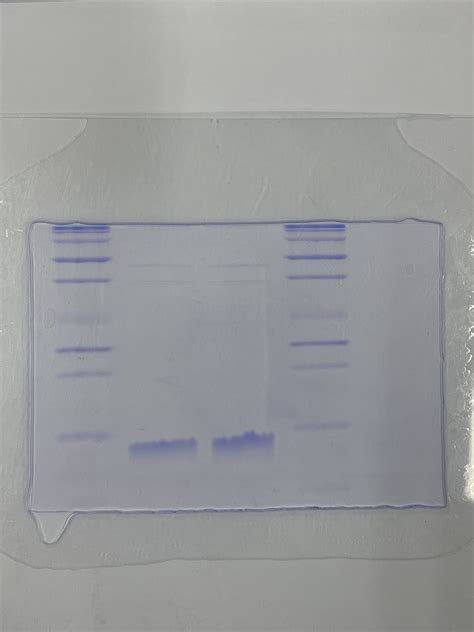 30 Questions With Answers In Tricine Sds Page Scientific Method