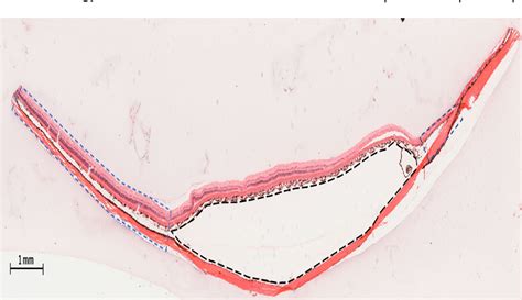 Figure 1 From Classifying Retinal Degeneration In Histological Sections