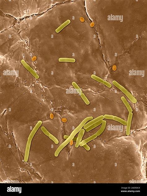 Coloured Scanning Electron Micrograph Sem Of Bacillus Anthracis Spore And Vegetative Stages
