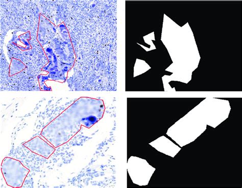 Examples Of Annotated Tiles A Original Tiles With Damaged Regions Download Scientific Diagram
