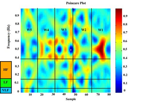 Wigner Ville Transform Of The Hrv Signal Of A Scd Person Download Scientific Diagram