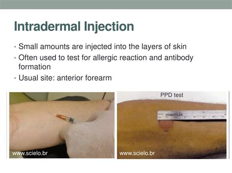 Ppt Injection For Medications Powerpoint Presentation Free Download