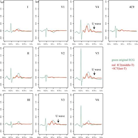 Results Of Independent Component Analysis Ica And Inverse Ica I‐ica