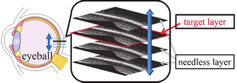 Problem Of Conventional Approach Download Scientific Diagram