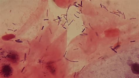Lactobacillus Introduction Morphology Pathogenicity Lab Diag