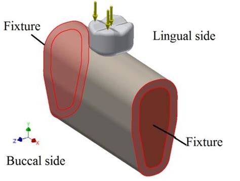Loading And Fixture Of The Model Model Was Meshed Into Tetrahedral