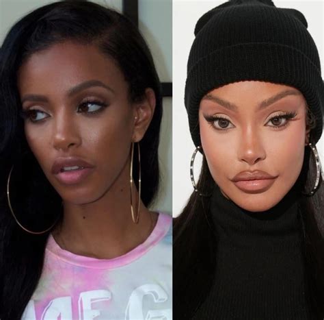 Yodit Yemane Rate Beforeafter Surgery Rvindictaratecelebs