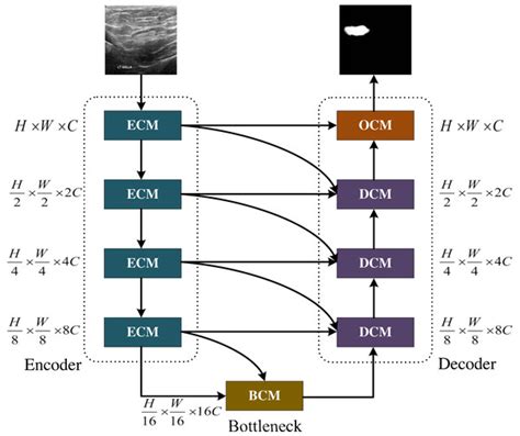 Mcnmf Unet A Mixture Conv Mlp Network With Multi Scale Features Fusion Unet For Medical Image