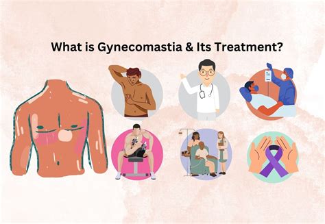 What Is Gynecomastia And Its Treatment Happiness Creativity