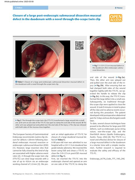 Pdf Closure Of A Large Post Endoscopic Submucosal Dissection Mucosal Defect In The Duodenum