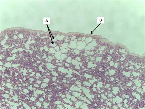 Solved Function And Location Of Structure Labeled A 1 Identify The 1 Answer Transtutors
