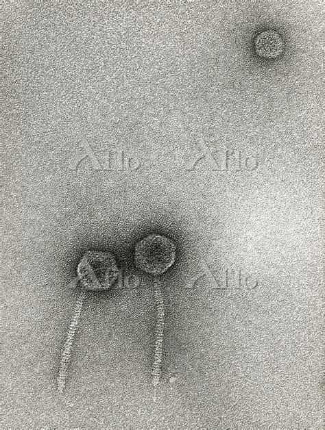 Transmission Electron Micrograph Of Lambda Bacteriophages