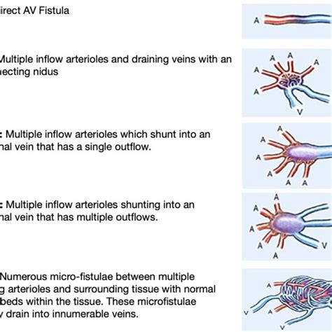Avm Classification By Yakes Et Al 9 Download Scientific Diagram