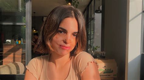 Se Quemó La Cara Con Soda Cáustica A Los 2 Años Y Cansada De Explicar