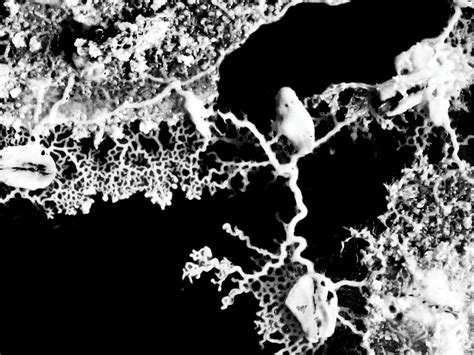 Sta 100 Physarum Polycephalum