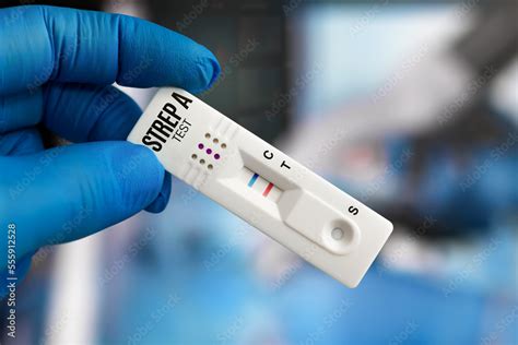 Labcorp Rapid Strep Test Code At Chad Adams Blog