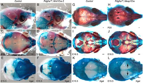 Activation Of Pdgfrα In Neural Crest Cells Or In Mesoderm Gives Rise To