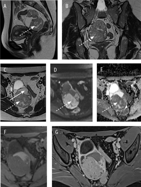 Orads таблица 60 фото