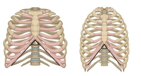 Wider Ribs After Pregnancy 5 Exercises To Fix Rib Flare