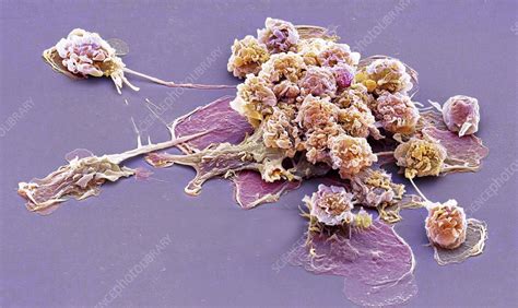 Activated Granulocytes Sem Stock Image C0603129 Science Photo