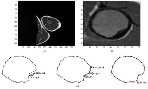Fractal Dimension Estimation Methods For Biomedical Images Intechopen