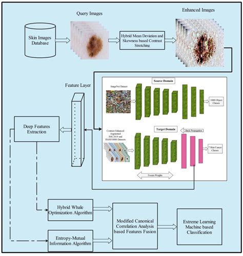 Proposed Multiclass Skin Lesion Classification Using Optimal Deep Download Scientific Diagram