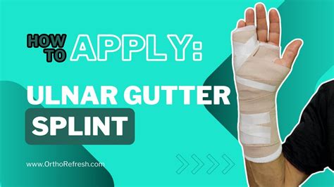 How To Apply An Ulnar Gutter Splint For A Broken Hand Boxer S Fracture YouTube