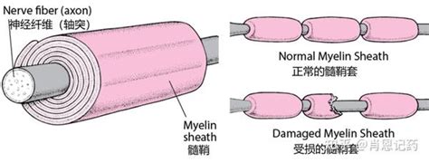 如何记住所有fda已上市生物药？ 白介素 6r（il 6r）拮抗剂 萨特利珠单抗 安适平 治疗视神经脊髓炎 知乎