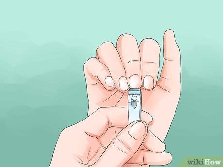 Ways To Treat Dermatitis WikiHow Health Ways To Treat Dermatitis WikiHow Health