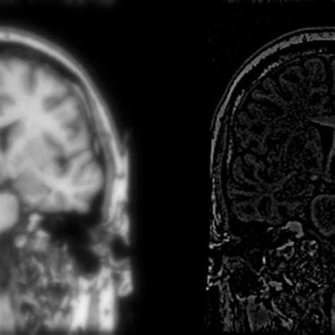 Resulting Images Of The Two Scale Decomposition Download Scientific Diagram