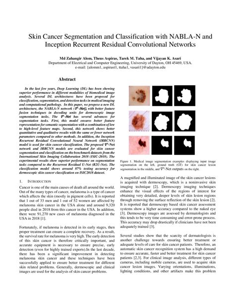 Skin Cancer Segmentation And Classification With Nabla N And Inception Recurrent Residual