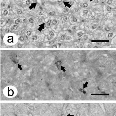 Bovine Liver Small Lipid Laden Vacuoles Arrows In The Cytoplasm Of