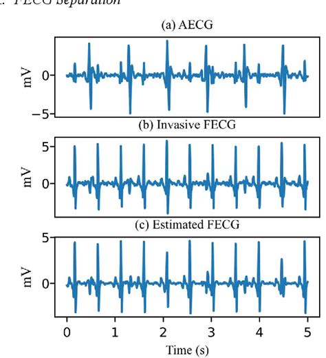 Figure 1 From Res Unet Based Fetal Electrocardiogram Extraction Via Time Frequency