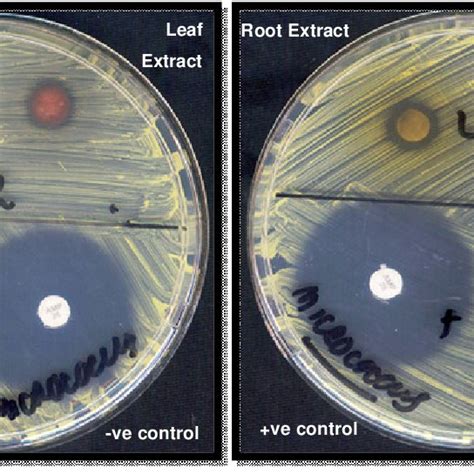 Antimicrobial Screening Showing Zones Of Inhibition Produced By Crude