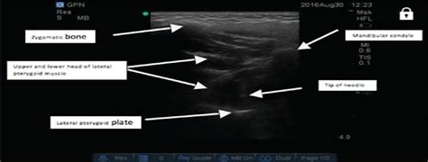 Saudi Journal Of Anaesthesia