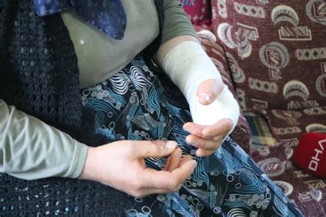 Köyde Korkunç Olay Evine Dönen 50 Yaşındaki Kadını Bu Hale Getirdi