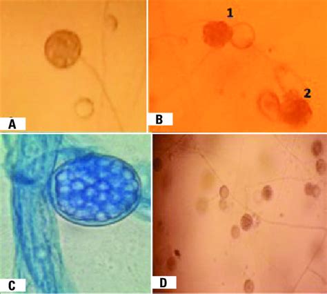 Estructuras De Pythium Posiblemente De La Especie Aphanidermatum A Download Scientific