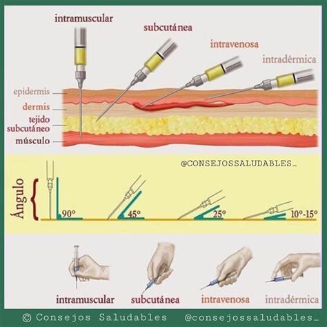 Tipos De Inyecciones ¿quieres Saber Más Síguenos👉🏼 Pideturemedio Es Importante Que Me Digas